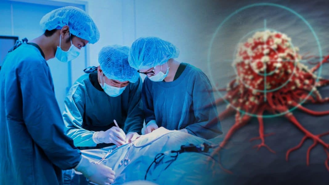 Paciente sobrevive a 12 tumores en España, y crea esperanzas para la ...