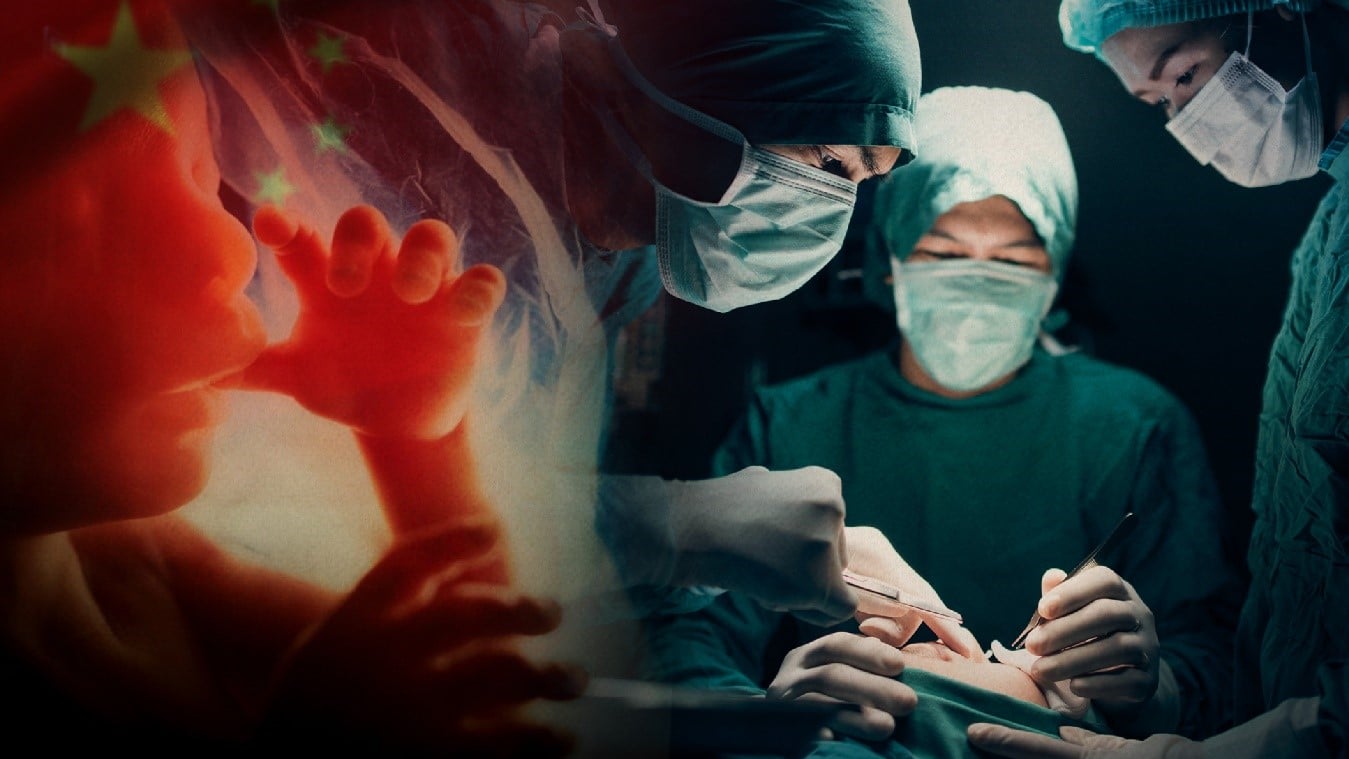 El insólito caso del ‘feto gemelo’ en el cerebro de una niña en China