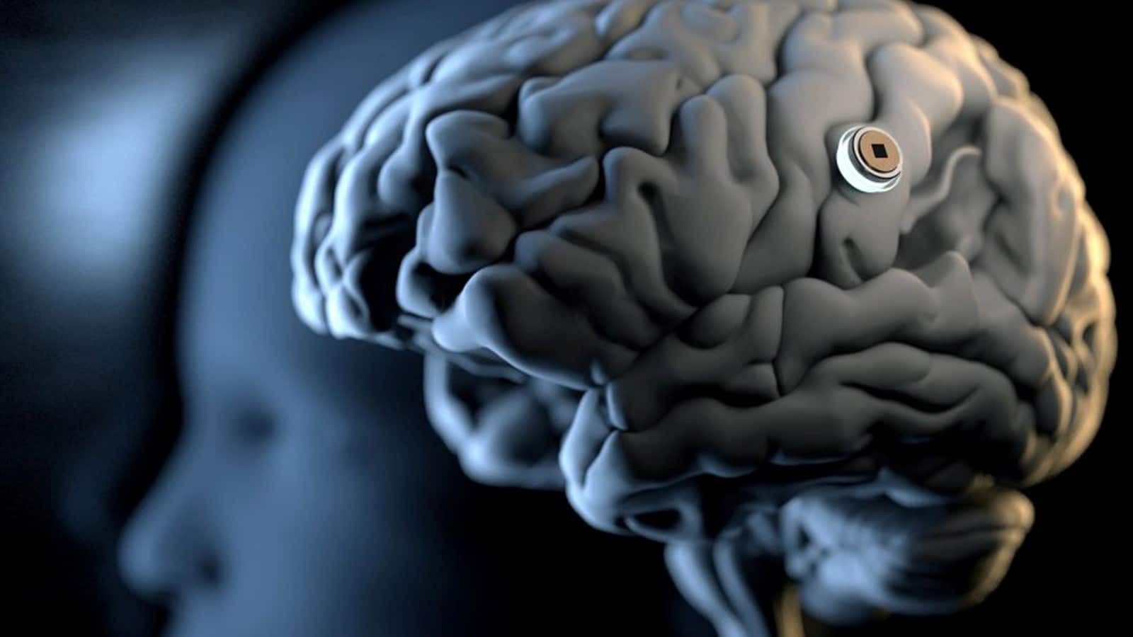 Implantan Chip Cerebral A Un Humano