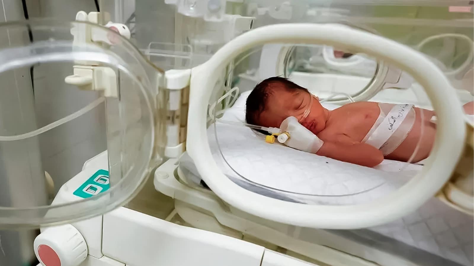 Rescatan Con Vida A Bebé Que Se Encontraba En El Vientre De Su Madre